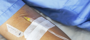 Administering intravenous iron in General Practice - GPEx
